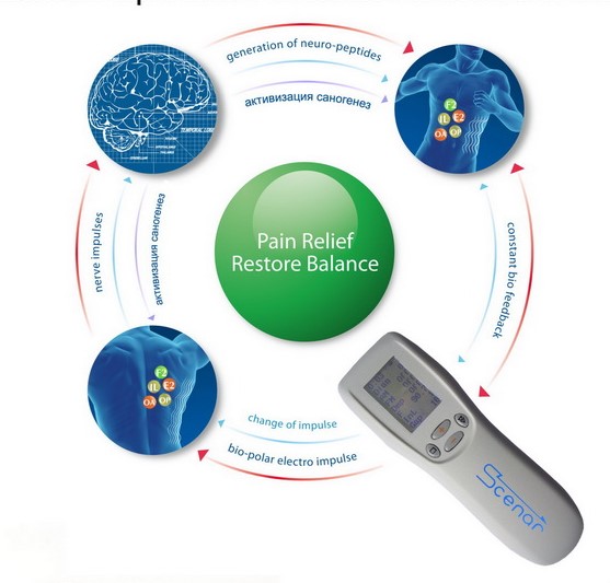 SCENAR therapy explained › RITMSCENAR