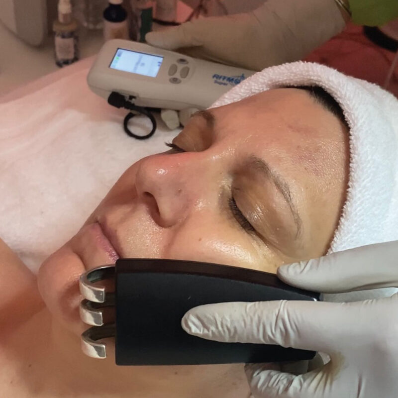 PREVENTION OF SKIN AGING USING SCENAR THERAPY