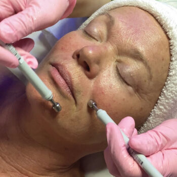 PREVENTION OF SKIN AGING USING SCENAR THERAPY