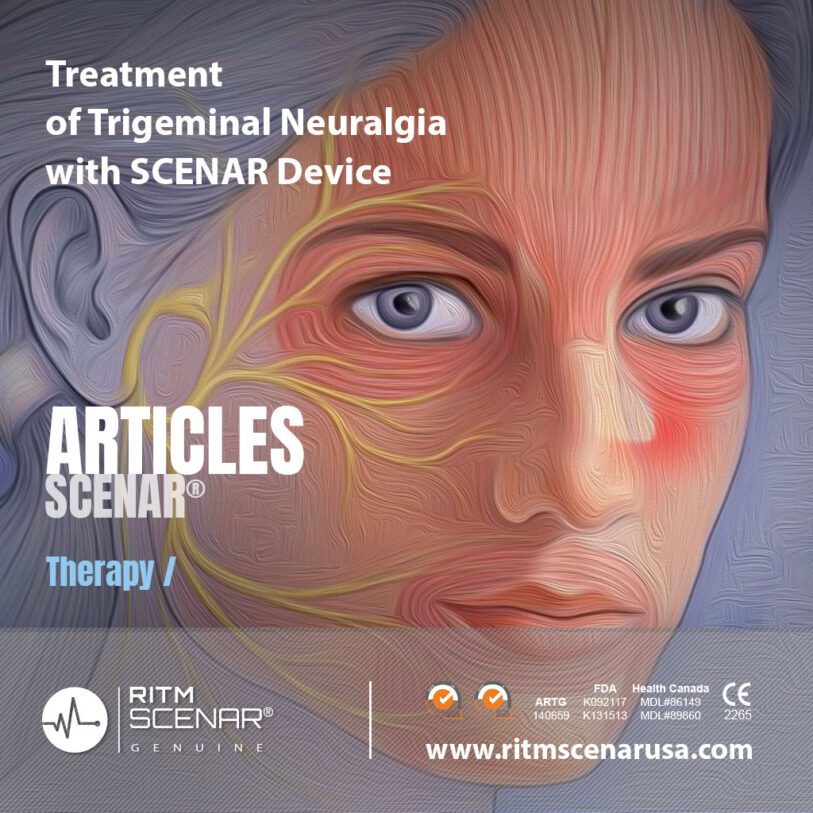 Treatment of Trigeminal Neuralgia with SCENAR Device › RITMSCENAR